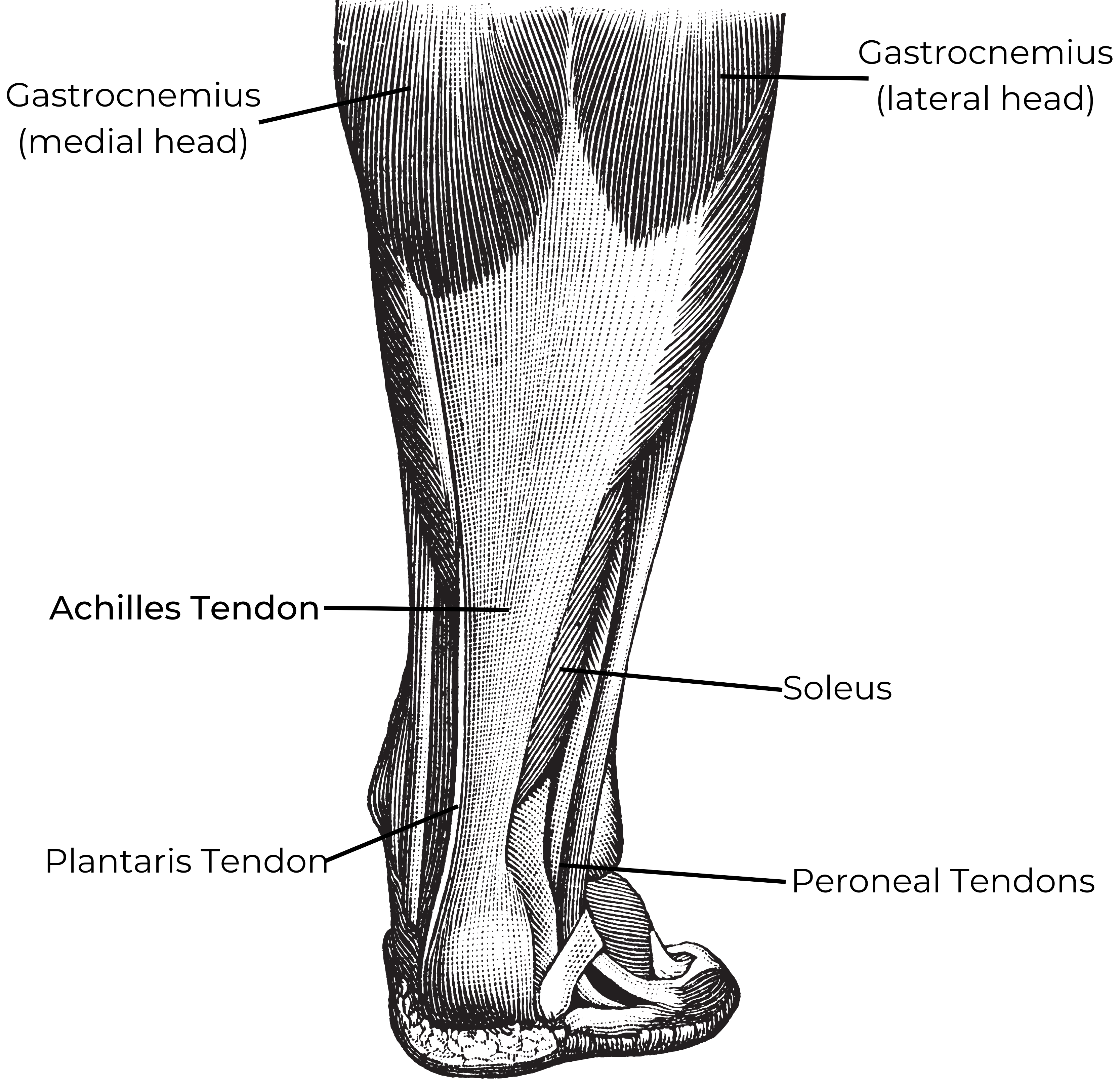 Ultrasound of the Achilles Tendon | IAME