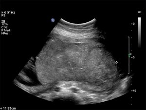 Sonographic Evaluation of the Normal and Abnormal Placenta | IAME