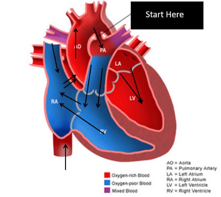 Fetal Right Heart Enlargement | IAME